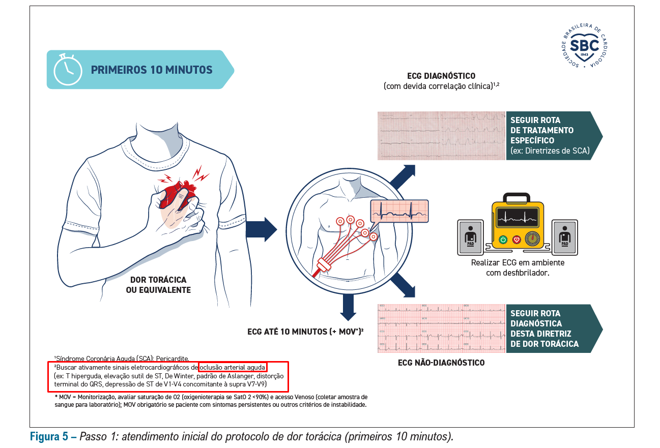 Diretriz brasileira de dor torácica – SBC 2025 - EmergPapers – Medicina ...