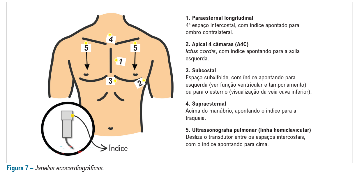Diretriz brasileira de dor torácica – SBC 2025 - EmergPapers – Medicina ...